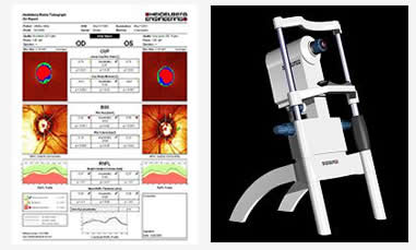 Optik Disk Muayenesi? – Glokom.Biz